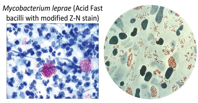 Structure Of Mycobacterium Leprae