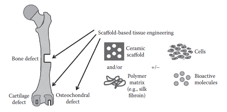 SCAFFOLD AND SCAFFOLD MATERIAL - Biology Ease