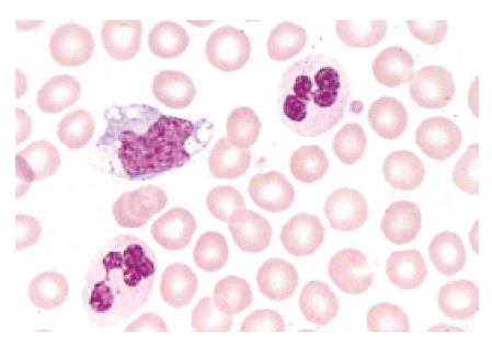 Granulocytes and their function - Biology Ease