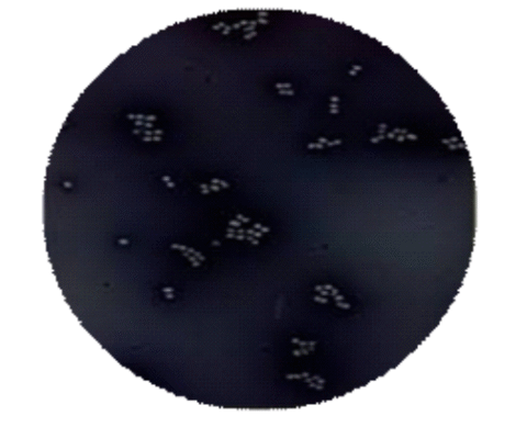 Negative Staining: Principle, Procedure, Results and Application ...