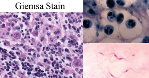Giemsa Stain- Principle, Procedure, Results, Applications - Biology Ease